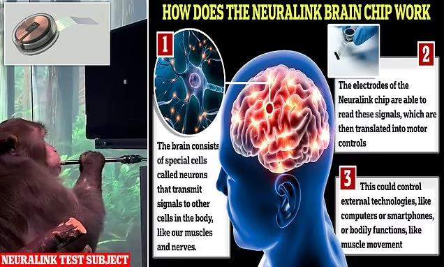 Elon Musk reveals first human has had a BRAIN implant from Neuralink’s ...