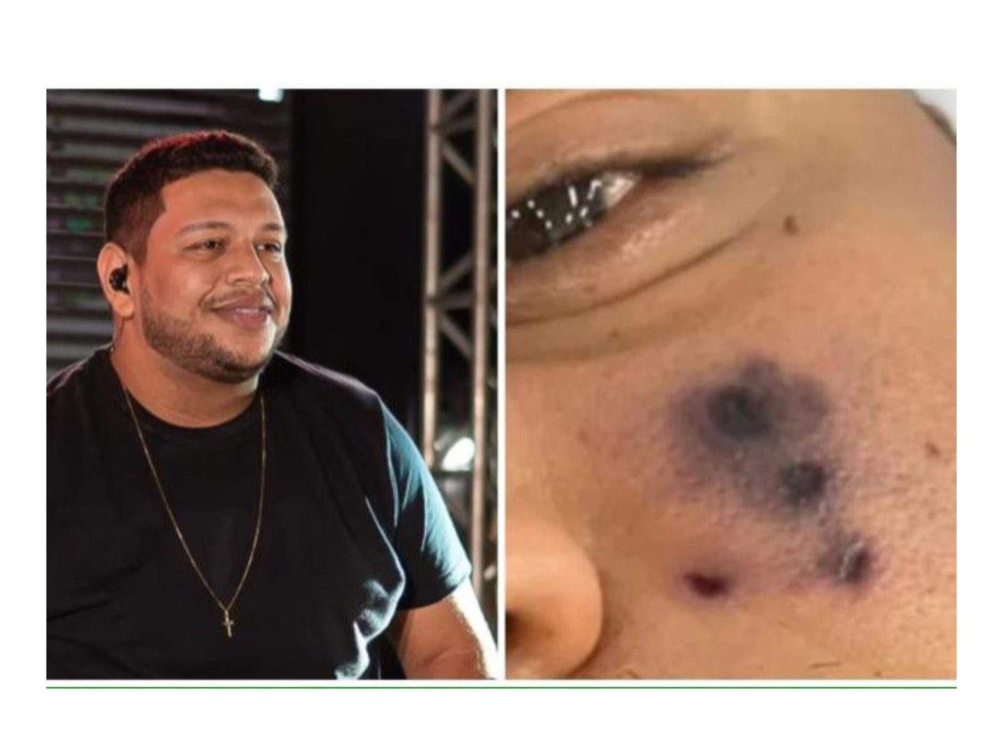 Popular Brazilian Singer Darlyn Morais Succumbs to Spider Bite ...