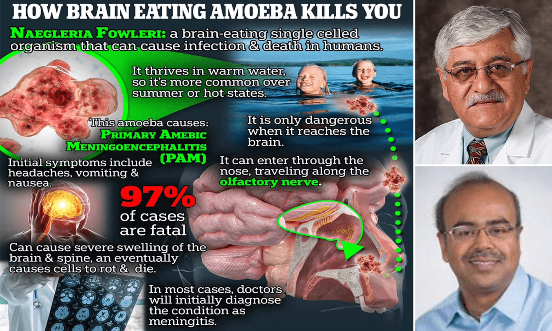 CDC issues warning against nasal rinsing with tap water after 10 ...